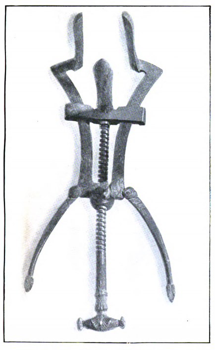 Roman Surgical Extraction Of Projectiles In Ancient Combat | Quintus ...